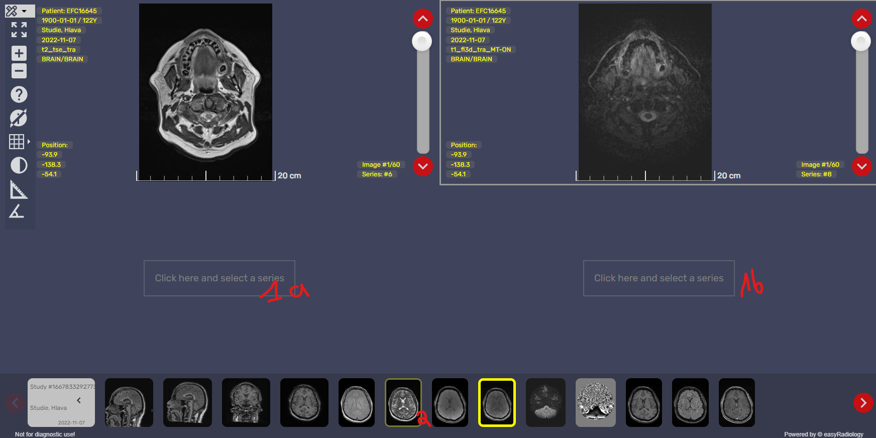 Navegar por exámenes de radiología en SmartZoom®
